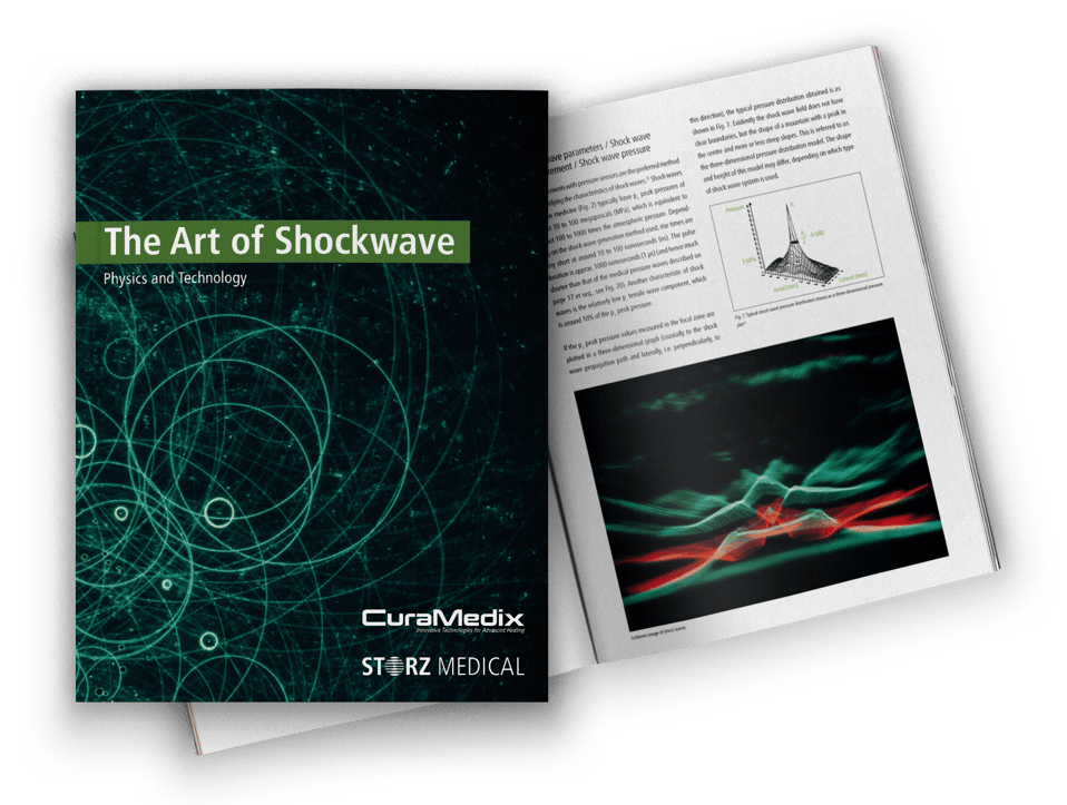 How to Implement EPAT Shockwave Therapy at Your Practice | PDF