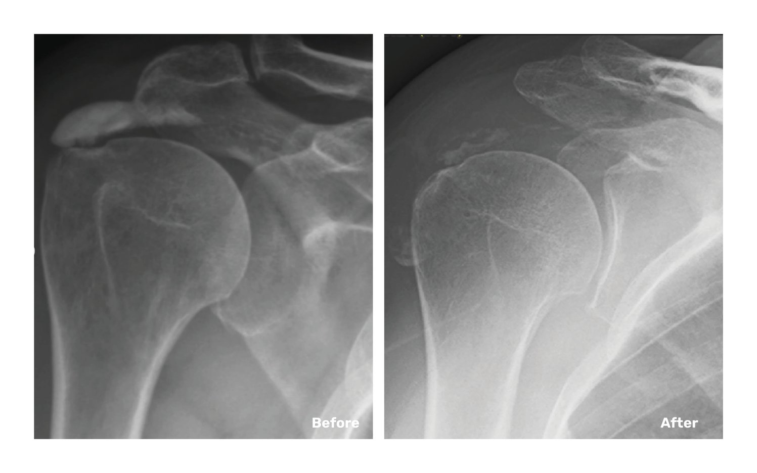 The Integration of Shockwave and EMTT: A Look at Modern Orthopedic Advances