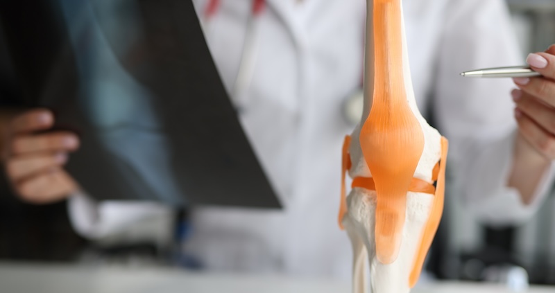 8 Orthopedic Alternatives to Surgery to Offer Your Patients