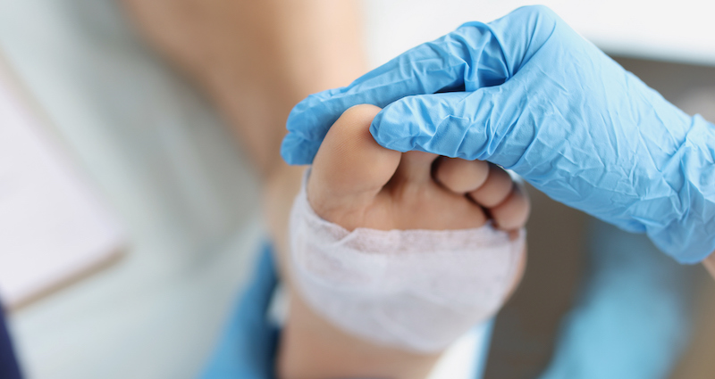 How Shockwave is Revolutionizing Wound Care Treatment